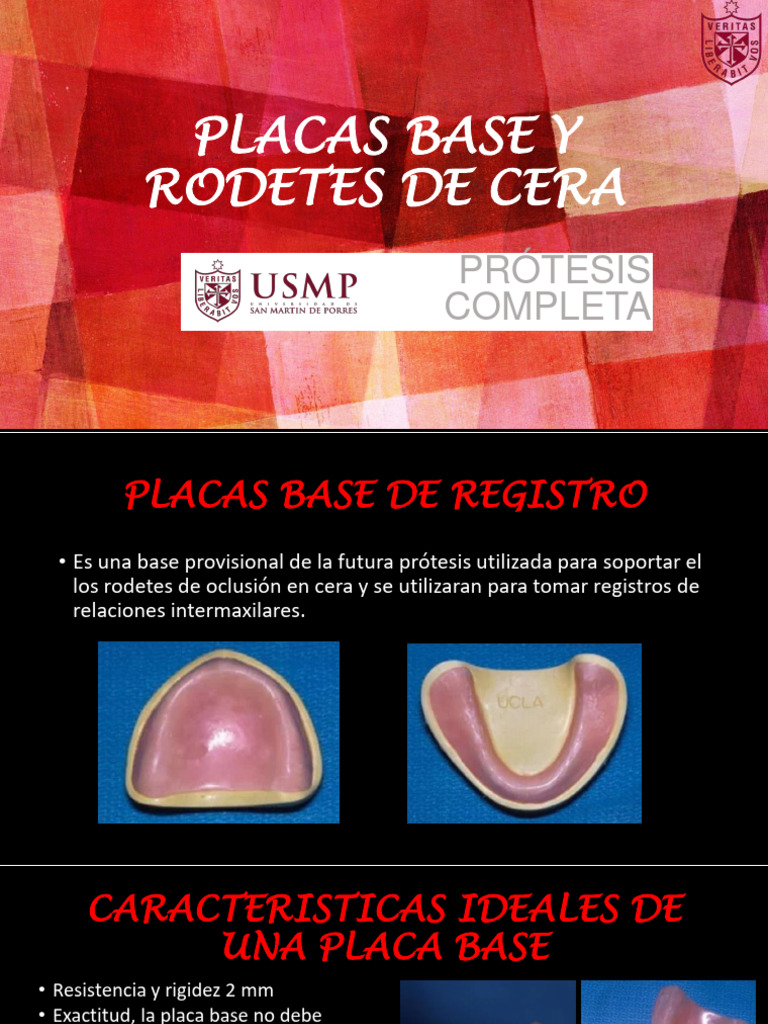 Placas Base y Rodetes de Cera en Prótesis Total | PDF | Estudios de ...