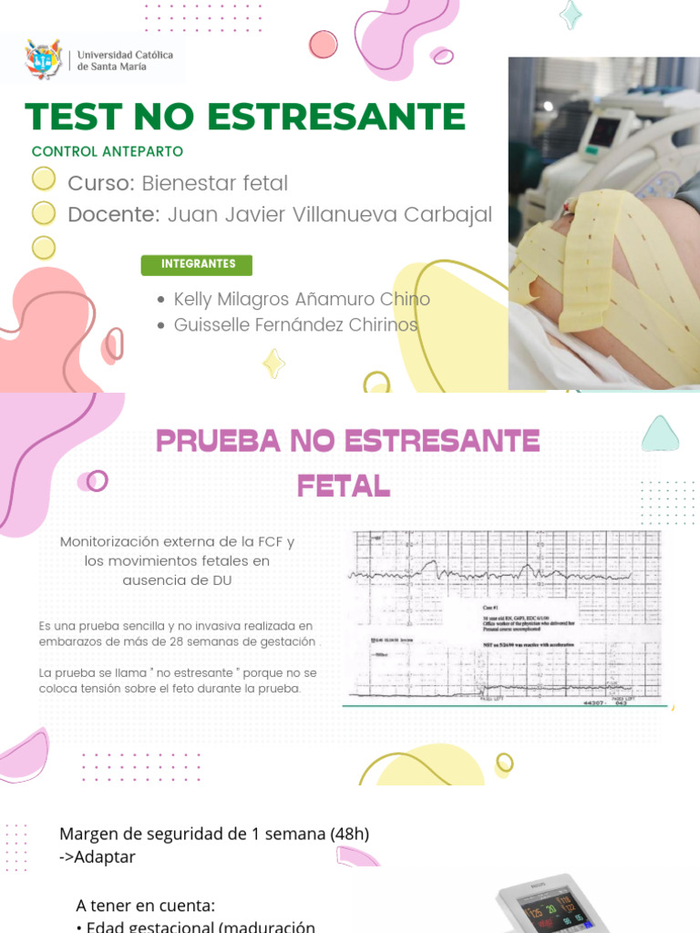 Test no estresante | PDF | Feto | El embarazo