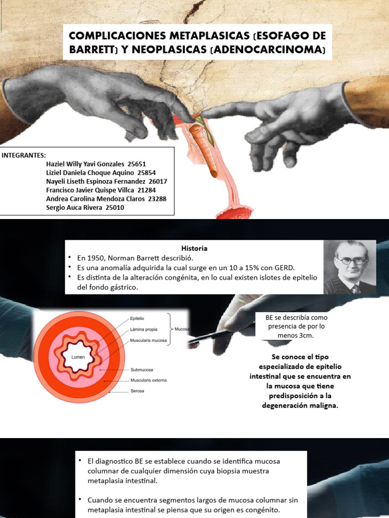 Cirugia Esofago de Barret Y NEOPLASICAS | PDF