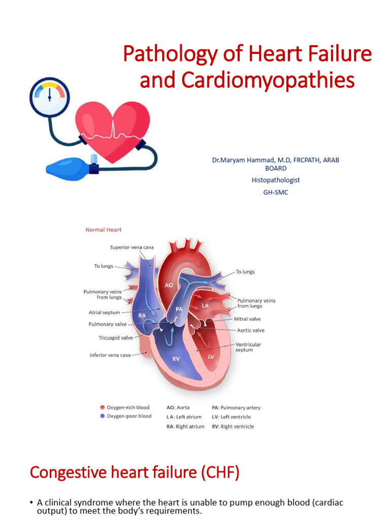 Pathology of Heart Failure and Cardiomyopathies | PDF | Heart Failure ...
