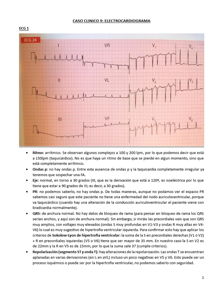 Caso 9 Ecg | PDF | Electrocardiografia | Cardiología