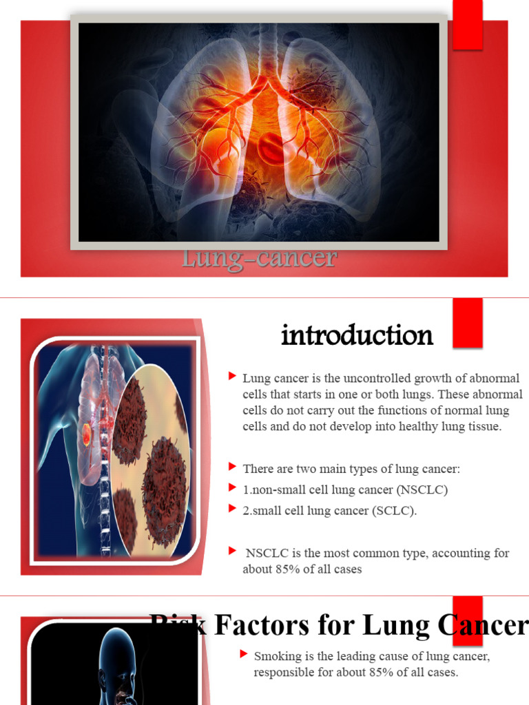Lung-cancer-1-1 | PDF | Lung Cancer | Cancer