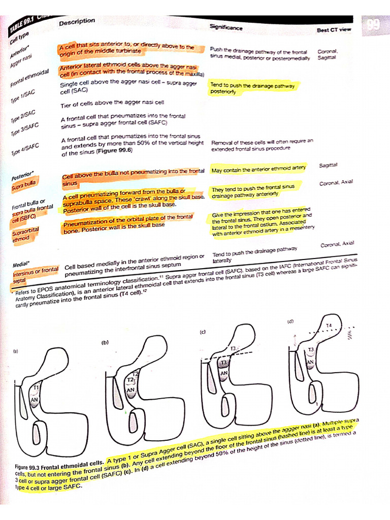 Frontal Recess | PDF