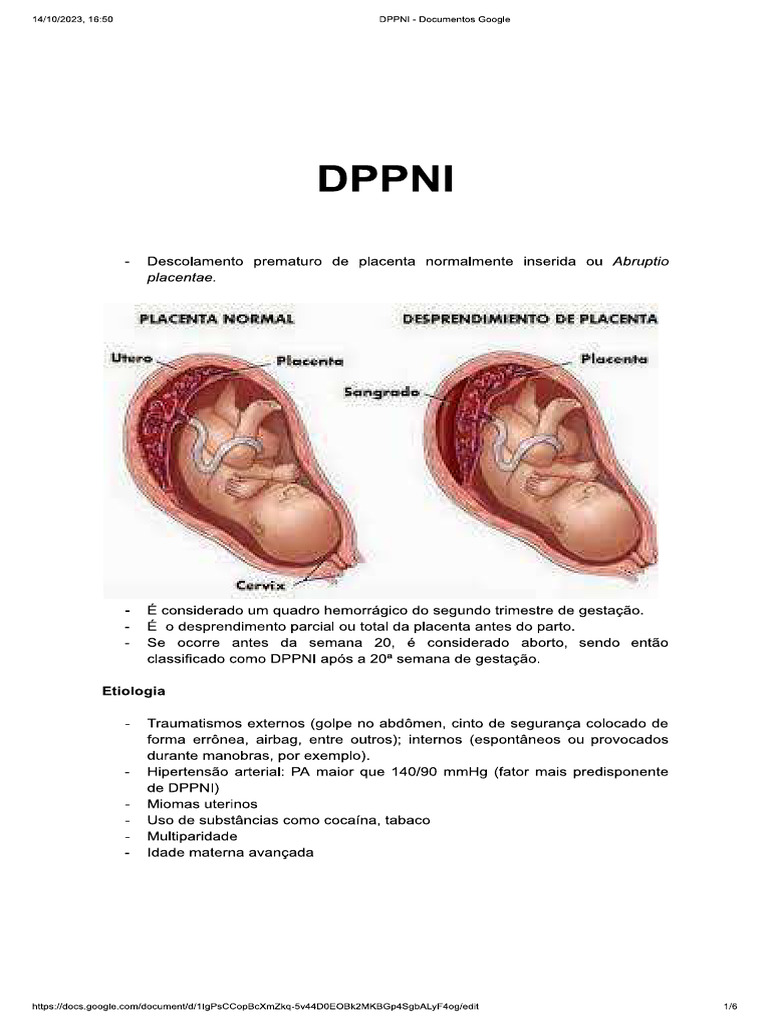 DPPNI | PDF