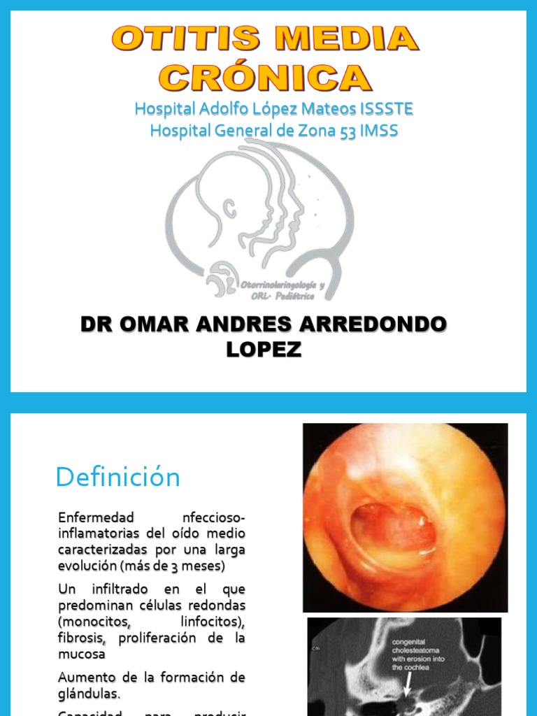 Clasificación y Tratamiento de Otitis Media | PDF ...