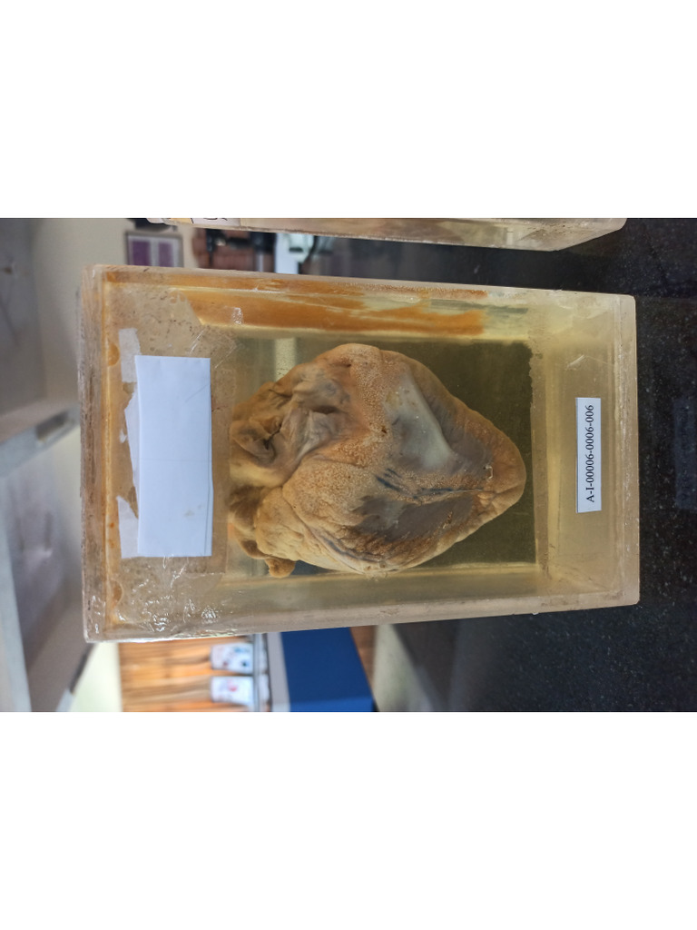 Patho Specimen | PDF