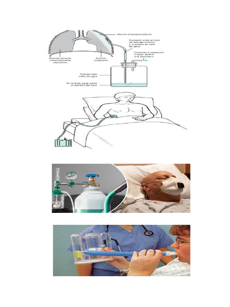 imagenes de oxigenoterapia | PDF