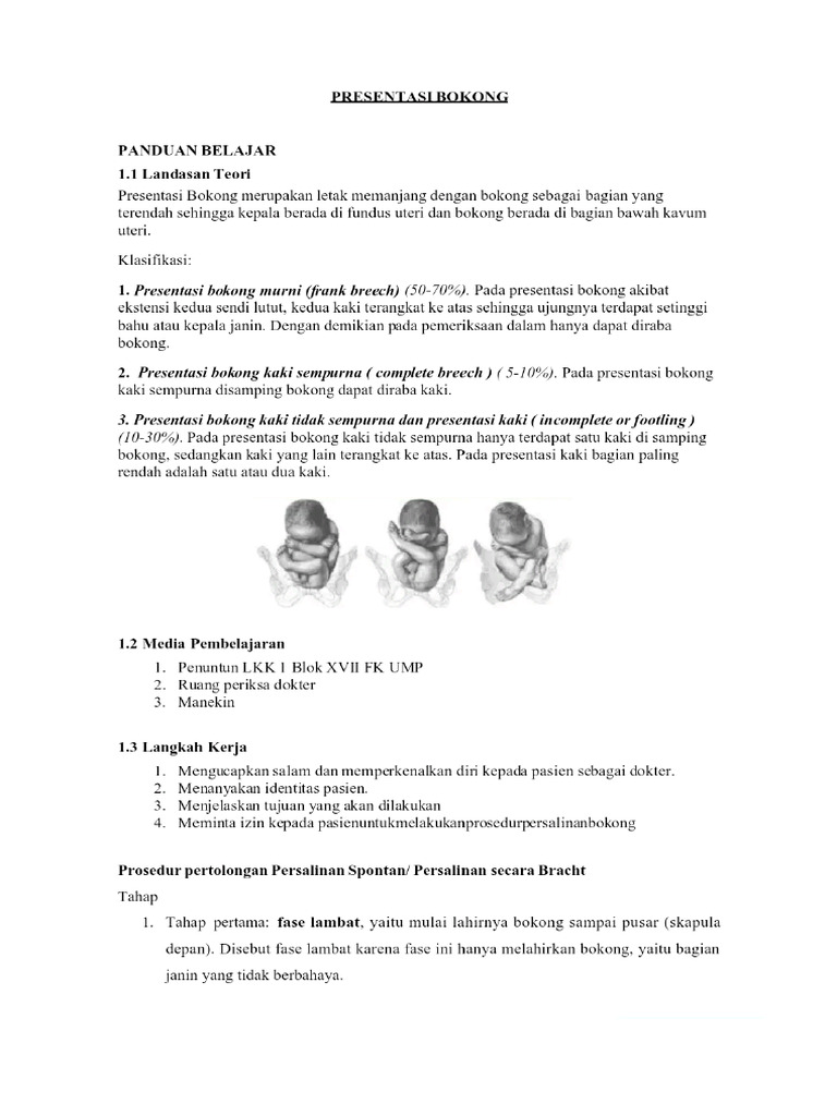 Persalinan Sungsang | PDF