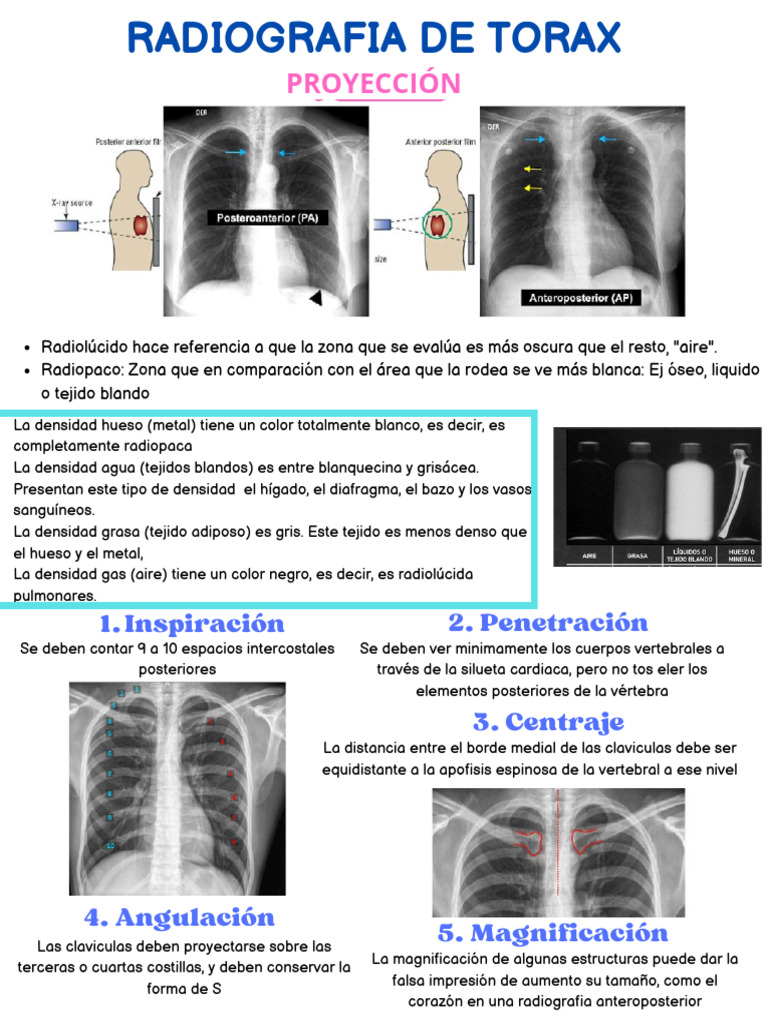 radiografia de torax | PDF | Corazón | Tórax
