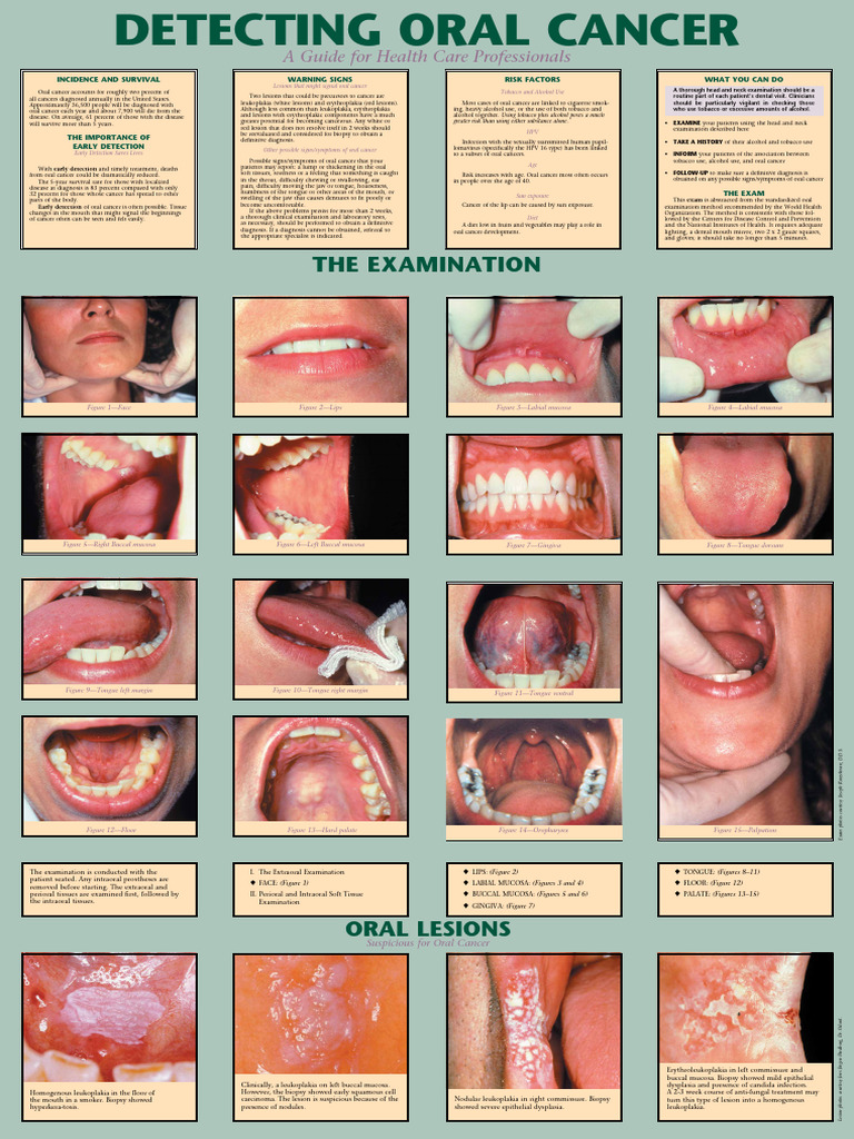 Oral Cancer Poster | PDF | Cancer | Head And Neck Cancer