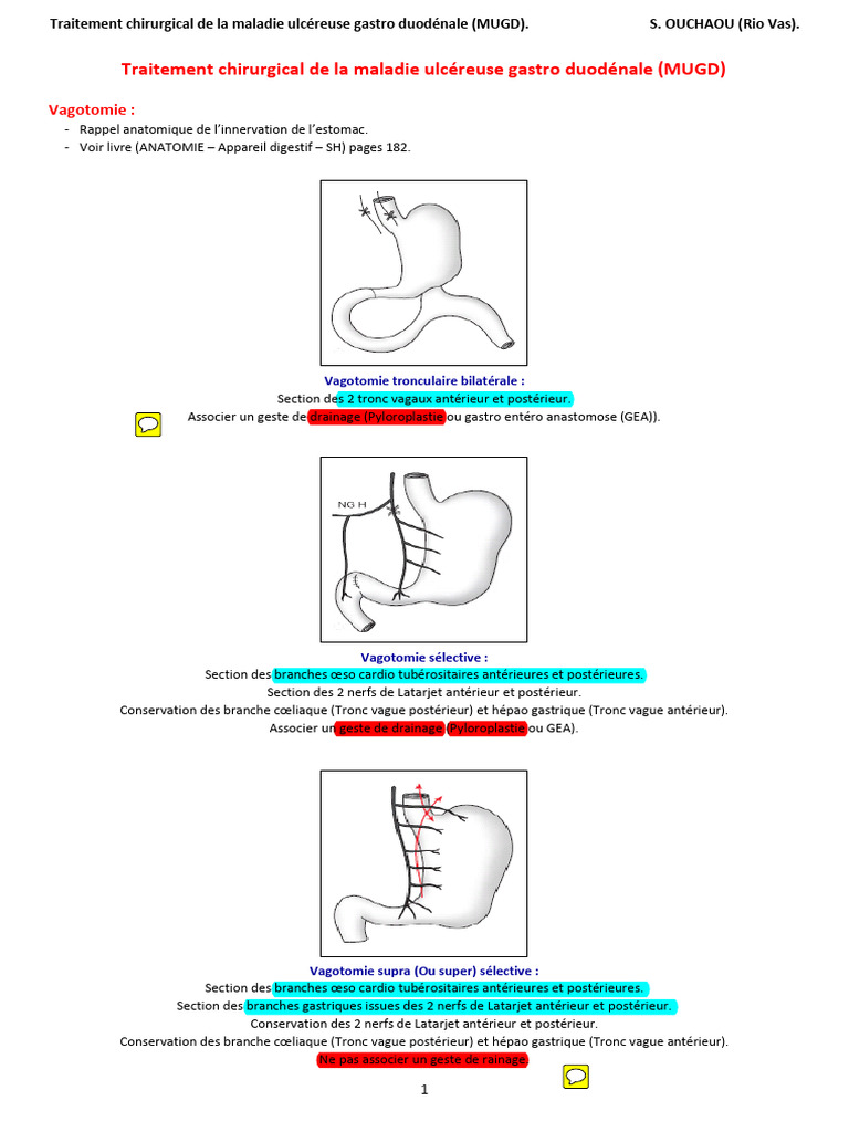 Chirurgie de la maladie ulcéreuse MUGD | PDF | Estomac | Gastroentérologie