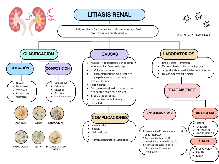 Litiasis Renal | PDF | Urología | Especialidades Medicas