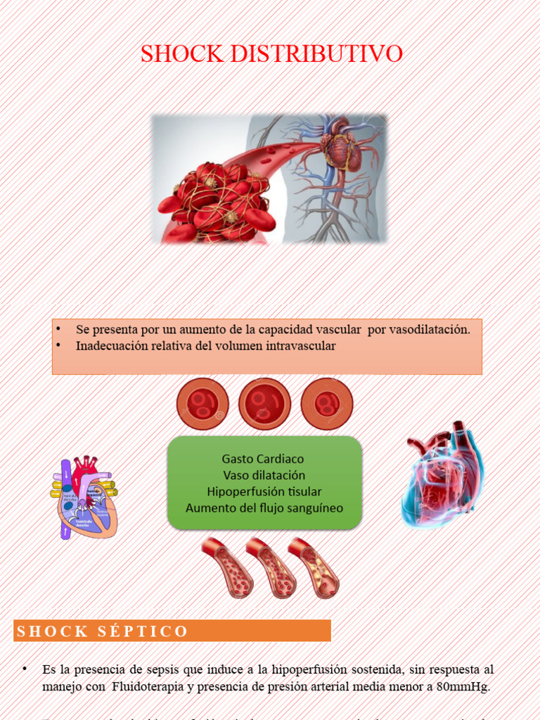 Shock Séptico: Causas y Tratamientos | PDF | Septicemia | Medicina CLINICA