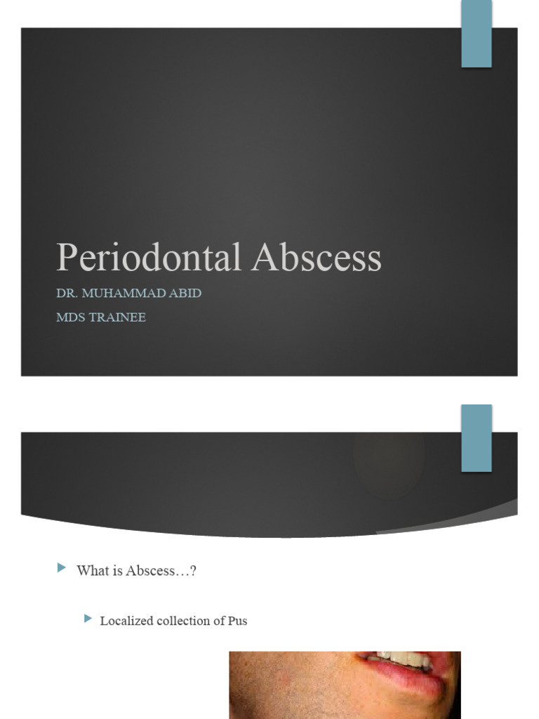 Abcess of Periodontium | PDF | Periodontology | Diseases And Disorders