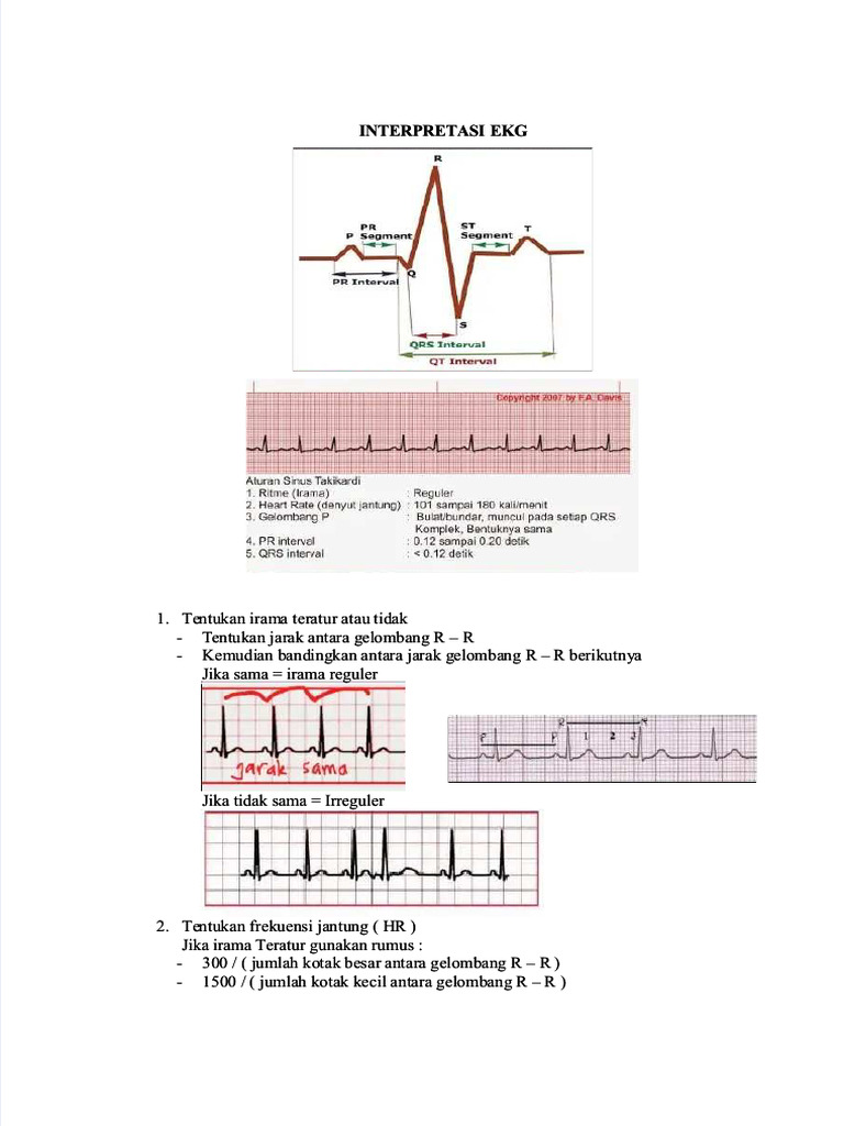 pdf-interpretasi-ekg_compress | PDF