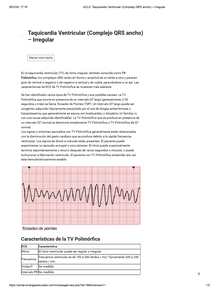 ACLS - Taquicardia Ventricular (Complejo QRS Ancho) - Irregular | PDF ...