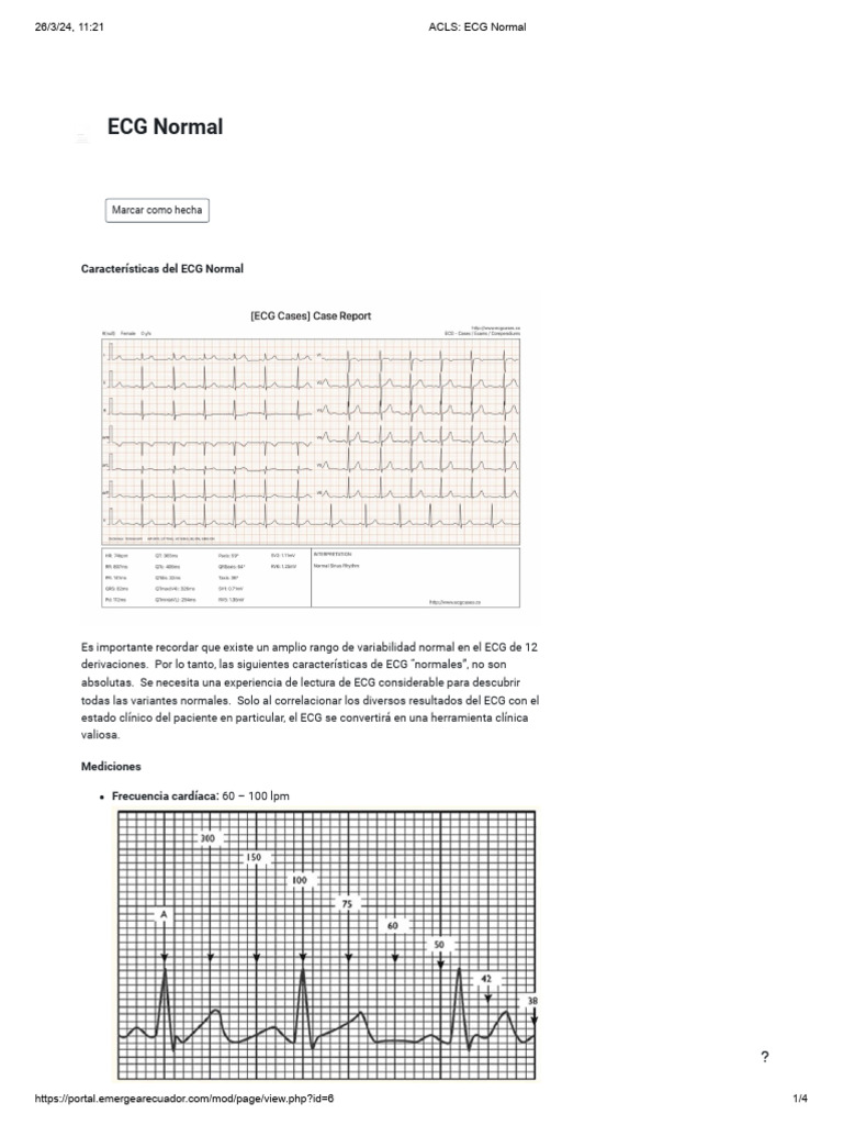 ACLS - ECG Normal | PDF | Electrocardiografia | Cardiología