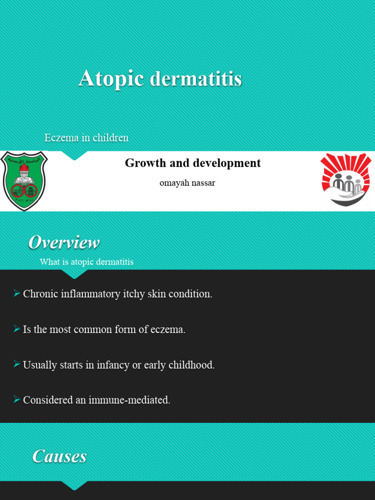 Understanding Atopic Dermatitis in Children | PDF | Dermatitis | Causes ...