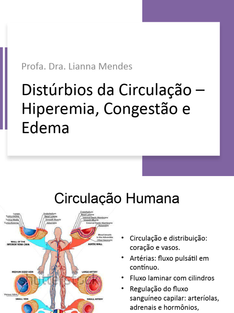 Hiperemia, Congestão e Edema na Circulação | PDF | Especialidades ...