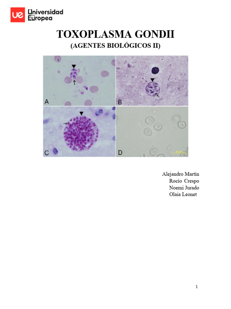 Toxoplasma Gondii Final 2 | PDF | Especialidades Medicas | Medicina CLINICA