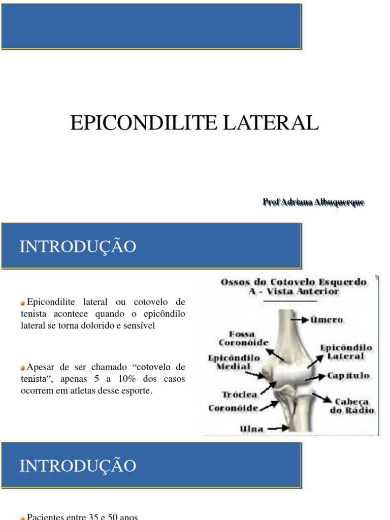 Aula 6 - Epicondilite Lateral | PDF | Doenças e distúrbios | Medicina ...