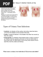 Urinary Tract Infection Presentation | PDF