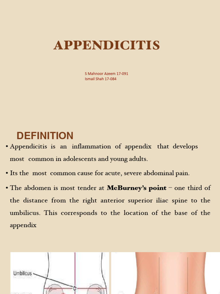 Appendicitis | Download Free PDF | Causes Of Death | Clinical Medicine