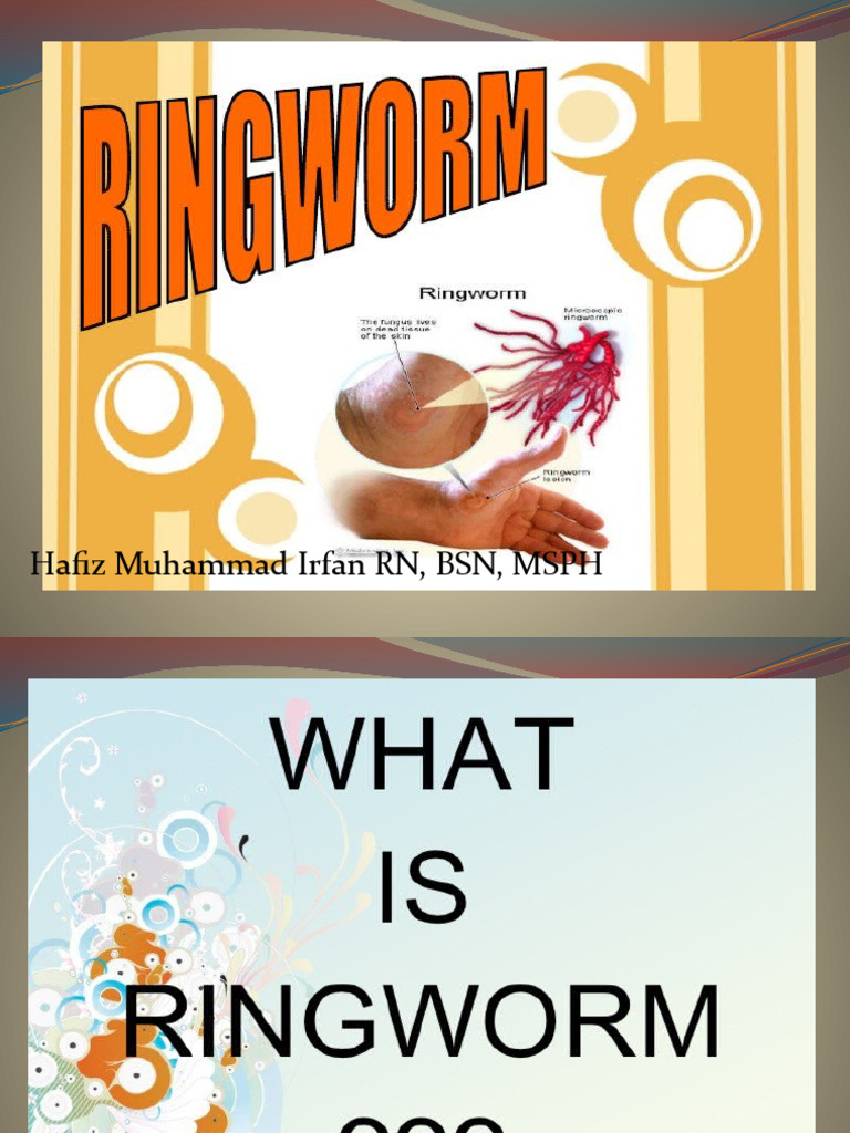 Ringworm | PDF