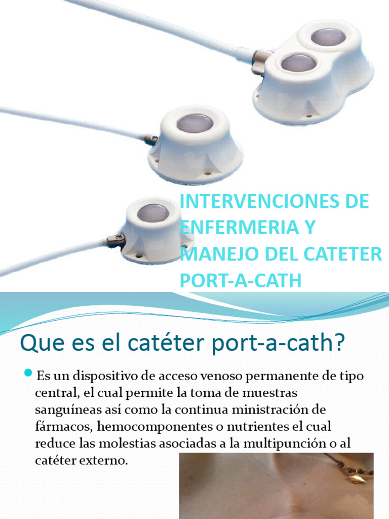 Alex y El Portcath | PDF