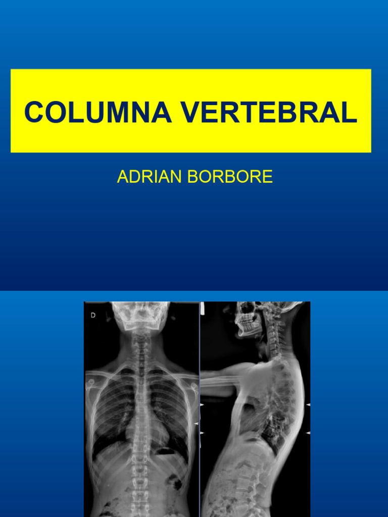 Clase de Columna | PDF | La columna vertebral | Vértebra
