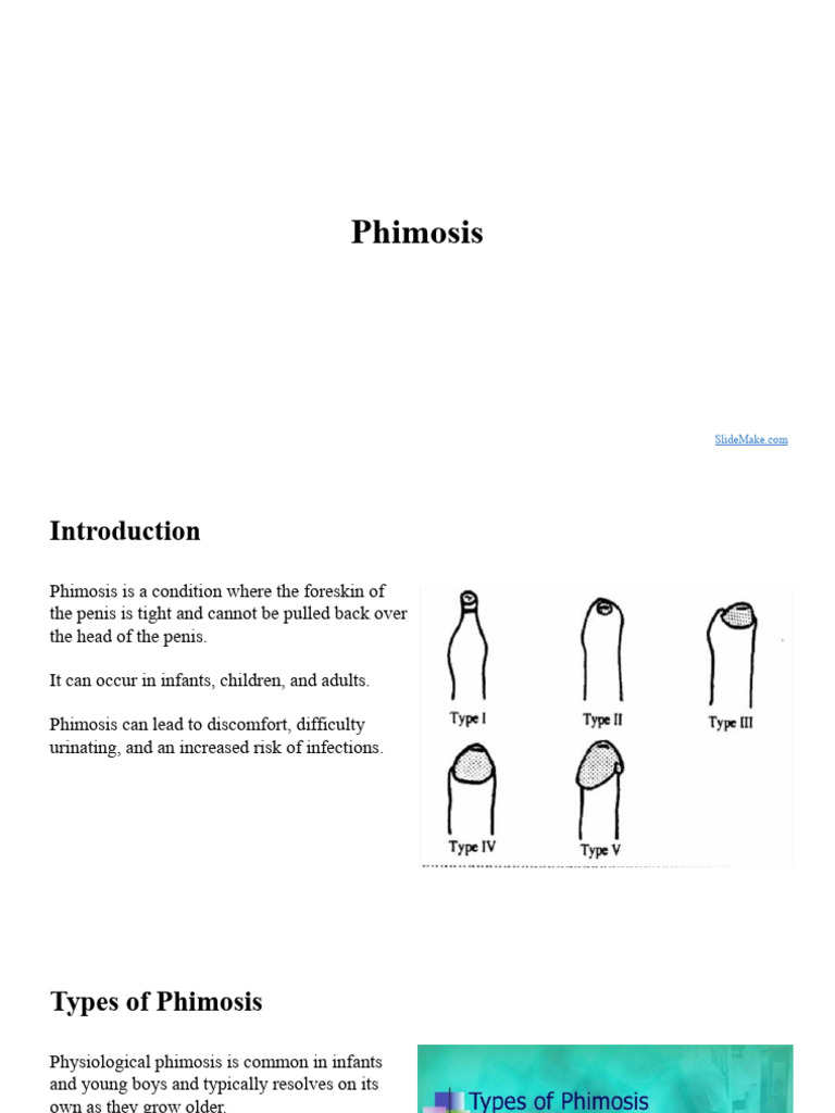 Phimosis | Download Free PDF | Health Sciences | Diseases And Disorders
