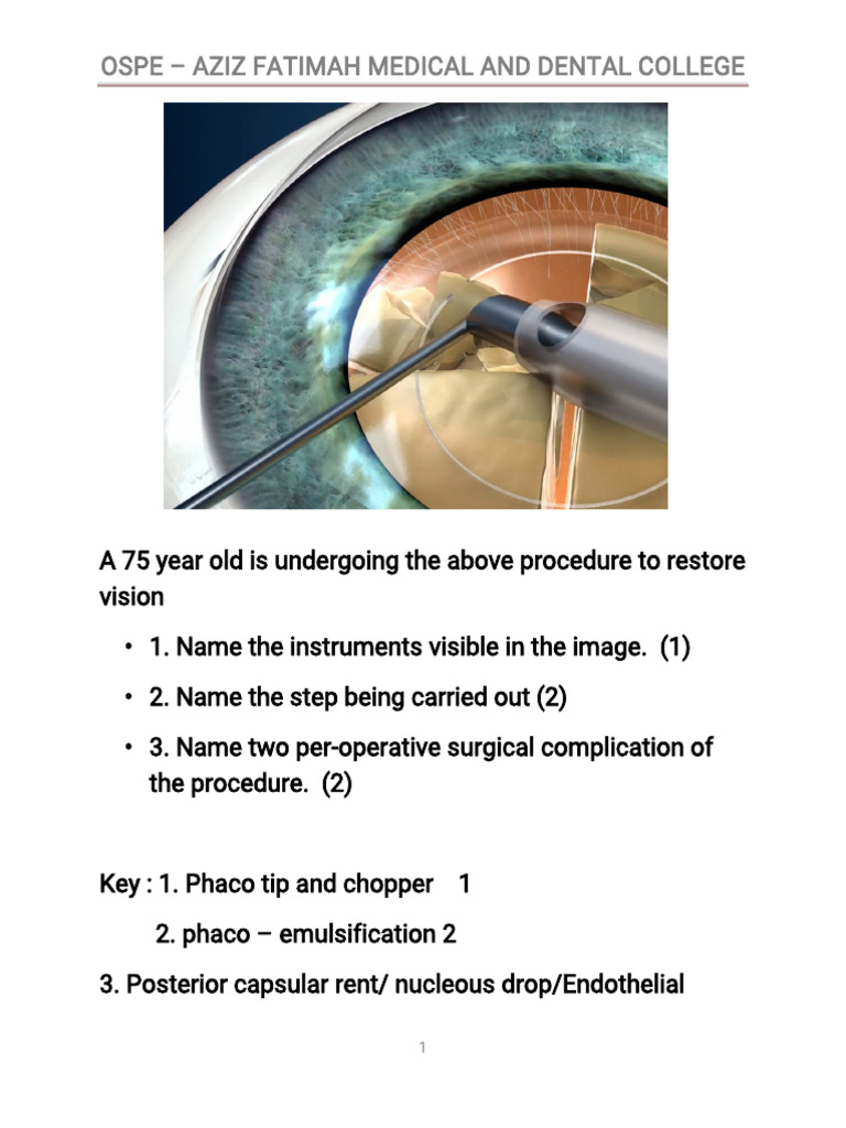 Eye Ospe Stuff | PDF