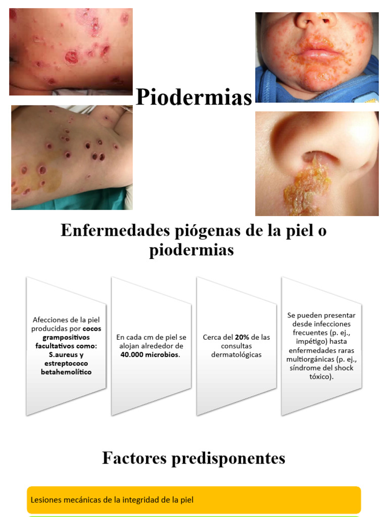 PIODERMIAS | PDF | Sistema inmune | Fagocito