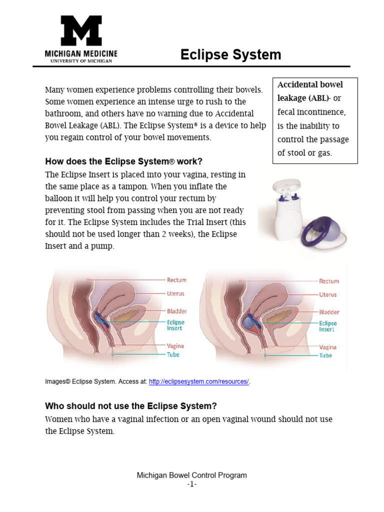 Eclipse System | PDF | Vagina | Medical Specialties