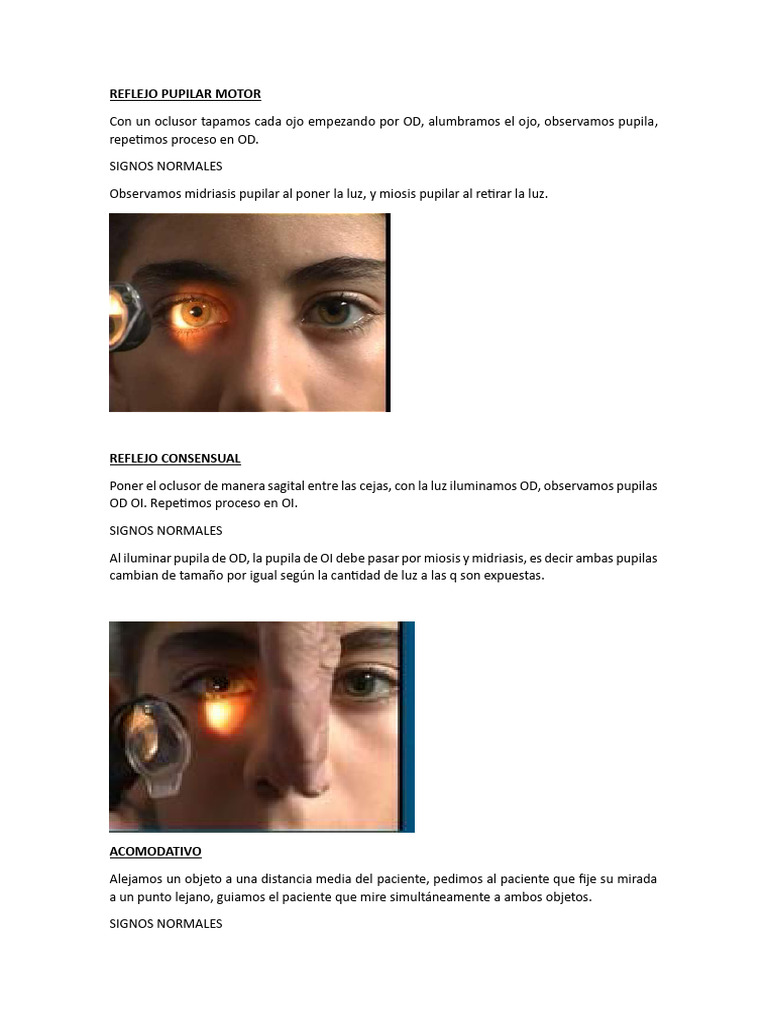 Evaluación de Reflejos Oculares | PDF | Ojo | Óptica