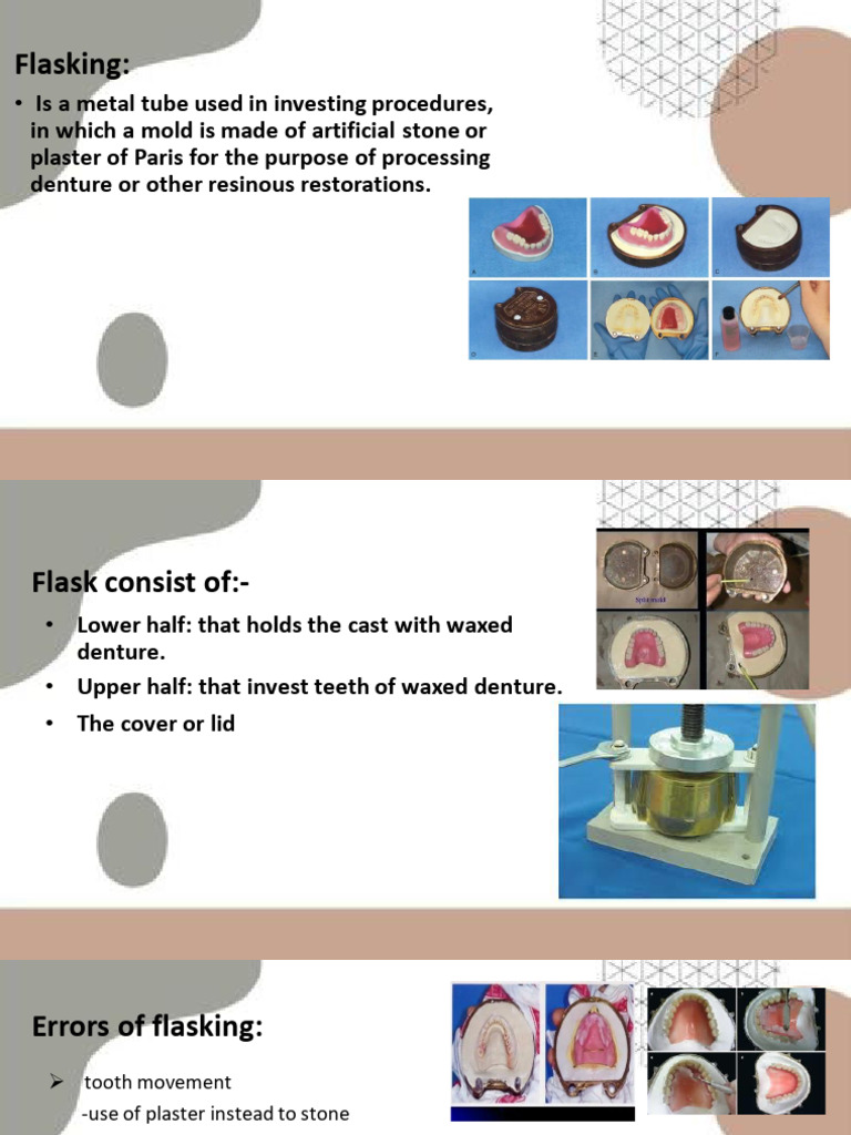 Flasking Procedure in Denture Processing | PDF