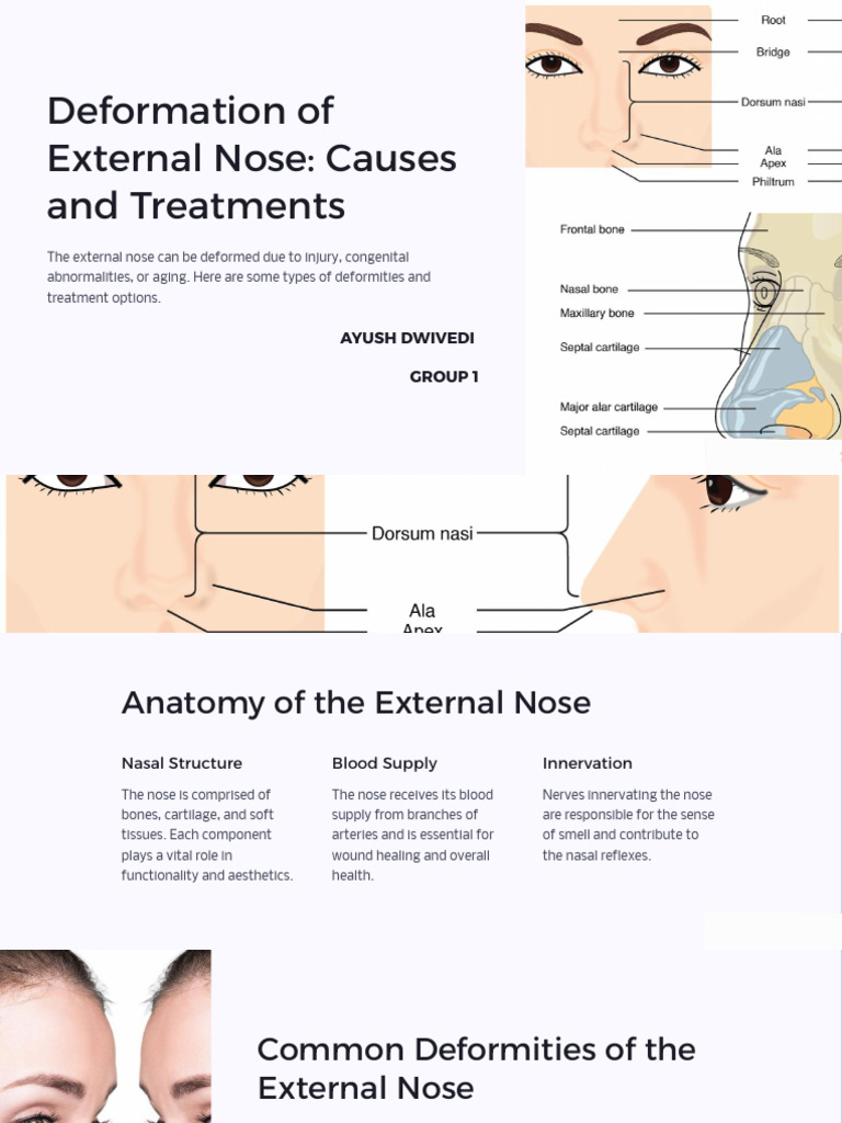 Introduction-To-Rhinoplasty PPT Ayush Dwivedi | PDF | Human Nose | Surgery Introduction-To-Rhinoplasty PPT Ayush Dwivedi | PDF | Human Nose | Surgery