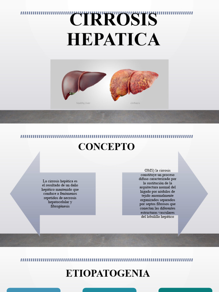 Cirrosis Hepatica | PDF | Cirrosis | Enfermedades y trastornos