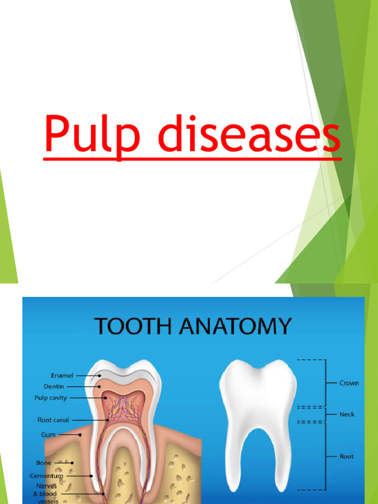 4 - Pulp Diseases | PDF | Inflammation | Dentin