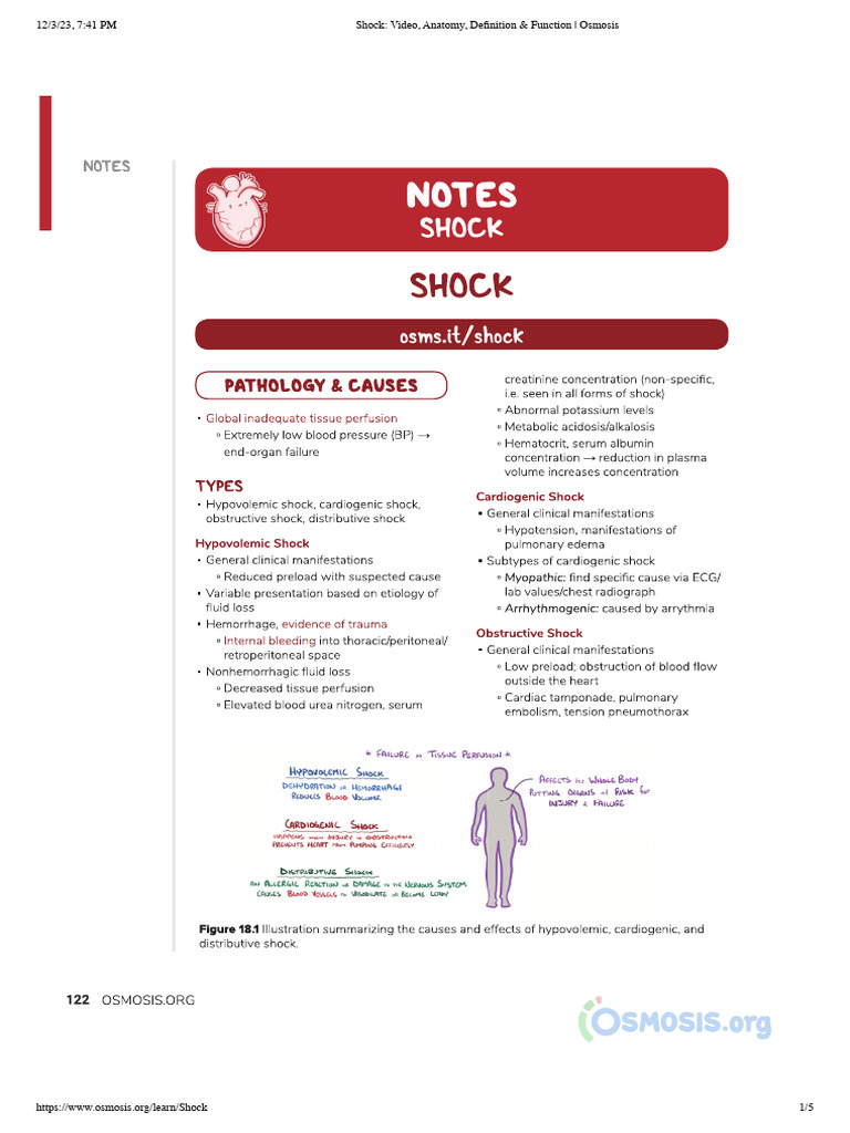 Shock - Video, Anatomy, Definition & Function - Osmosis | PDF Shock - Video, Anatomy, Definition & Function - Osmosis | PDF