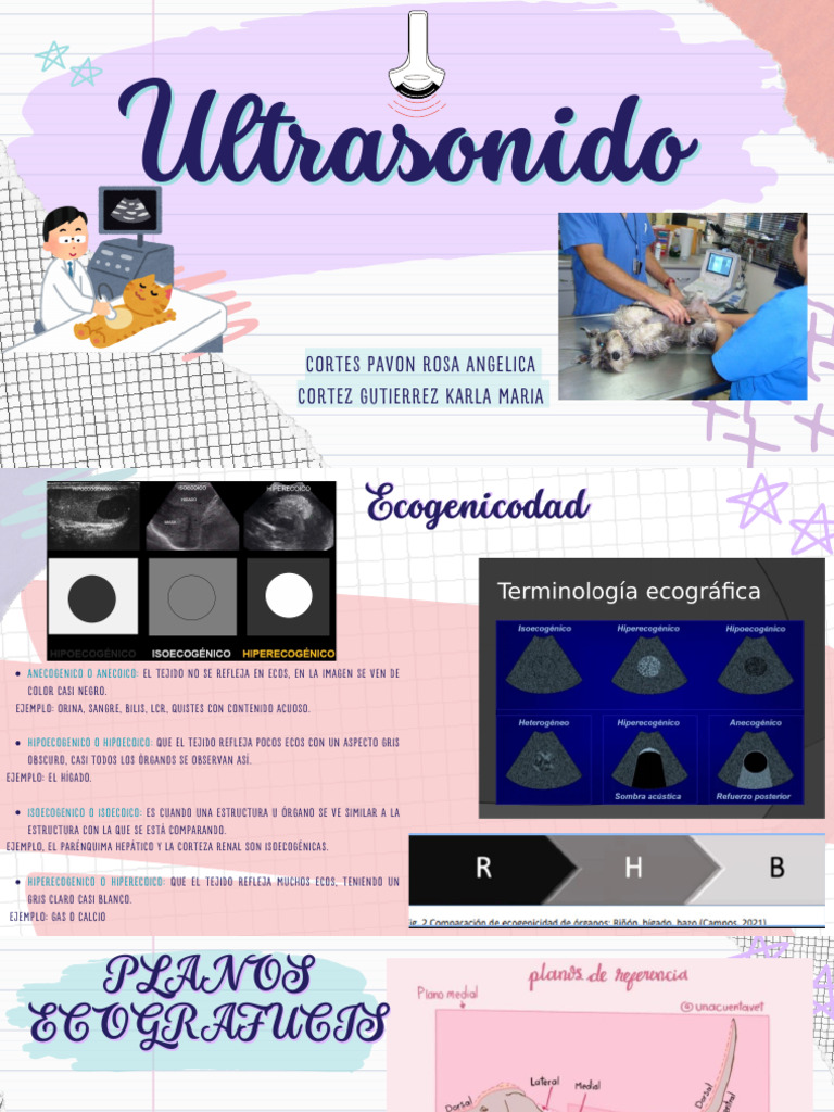 Presentación Ultrasonido | PDF | Ultrasonido | Efecto Doppler