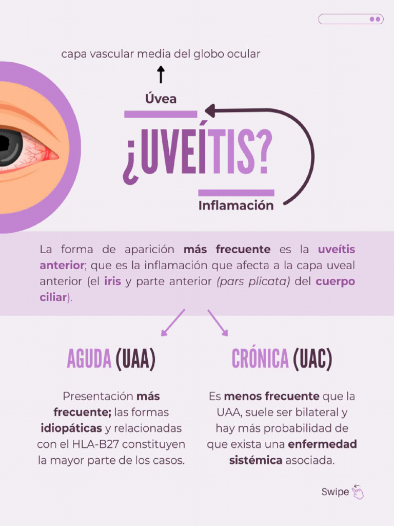 Uveitis | PDF