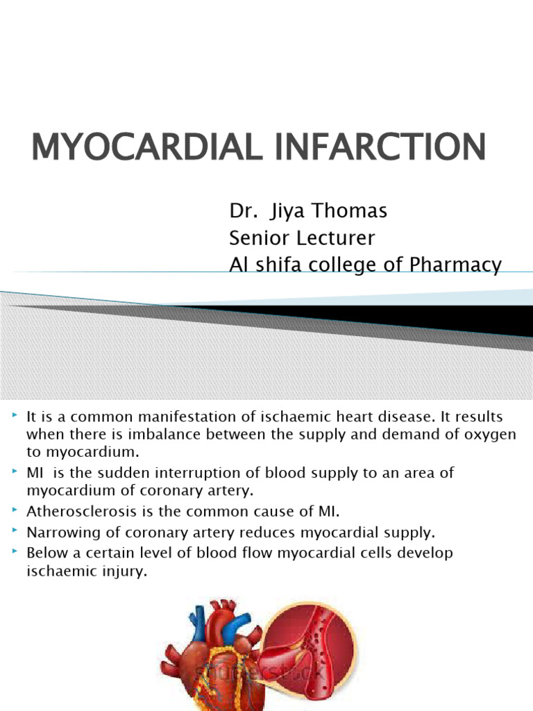 Understanding Myocardial Infarction Causes | PDF