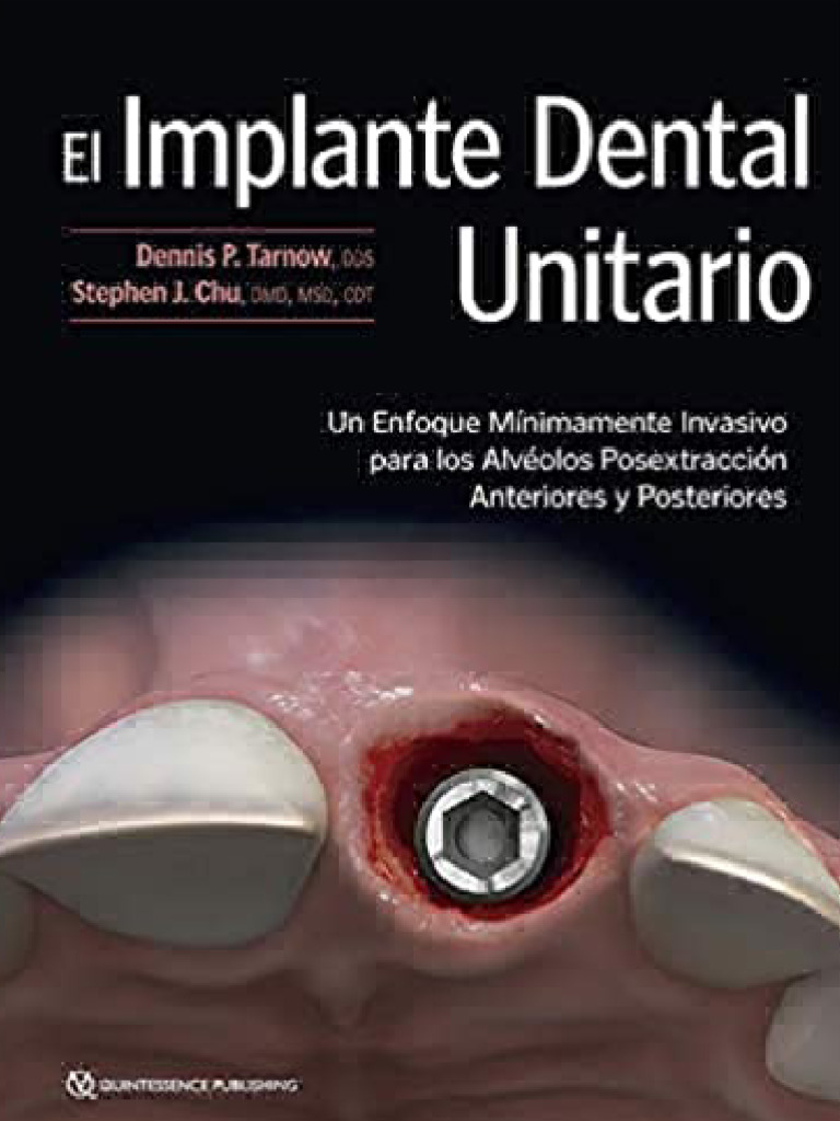 El Implante Unitario Tarnow Esp NEW | PDF | Implante dental | Odontología