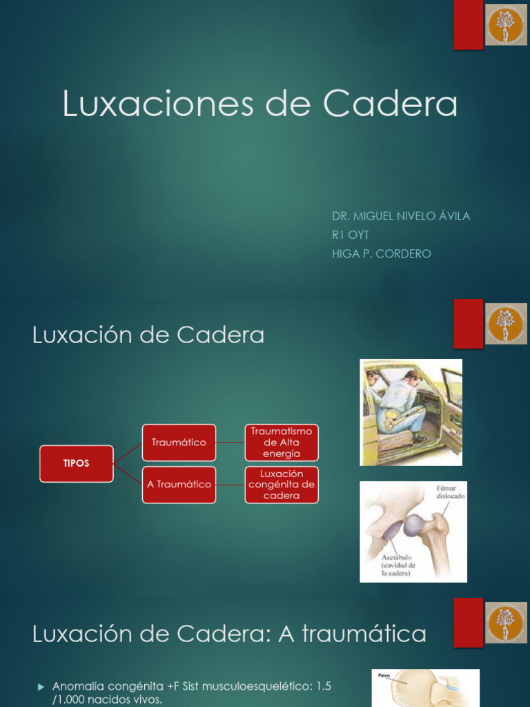 Luxaciones de Cadera | PDF | Rodilla | Enfermedades y trastornos