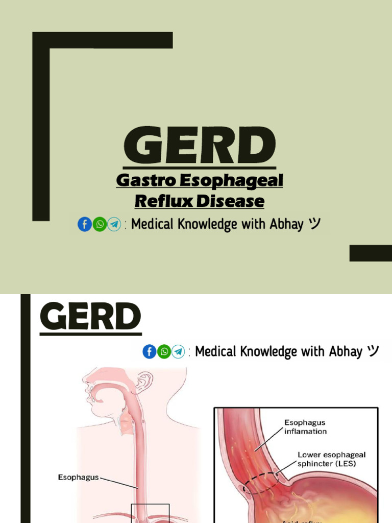 GERD | PDF | Gastroesophageal Reflux Disease | Esophagus