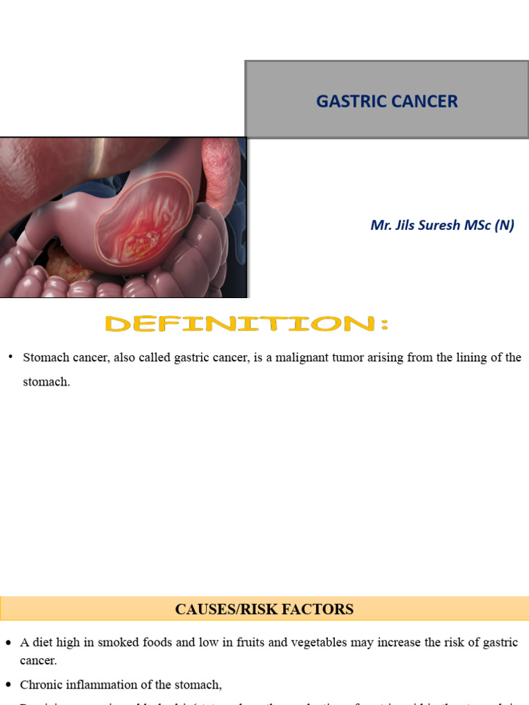 Gastric Cancer | PDF | Cancer | Indigestion
