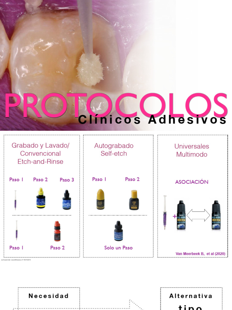 Protocolos Clinicos de Adhesión | PDF | Esmalte de dientes | Boca