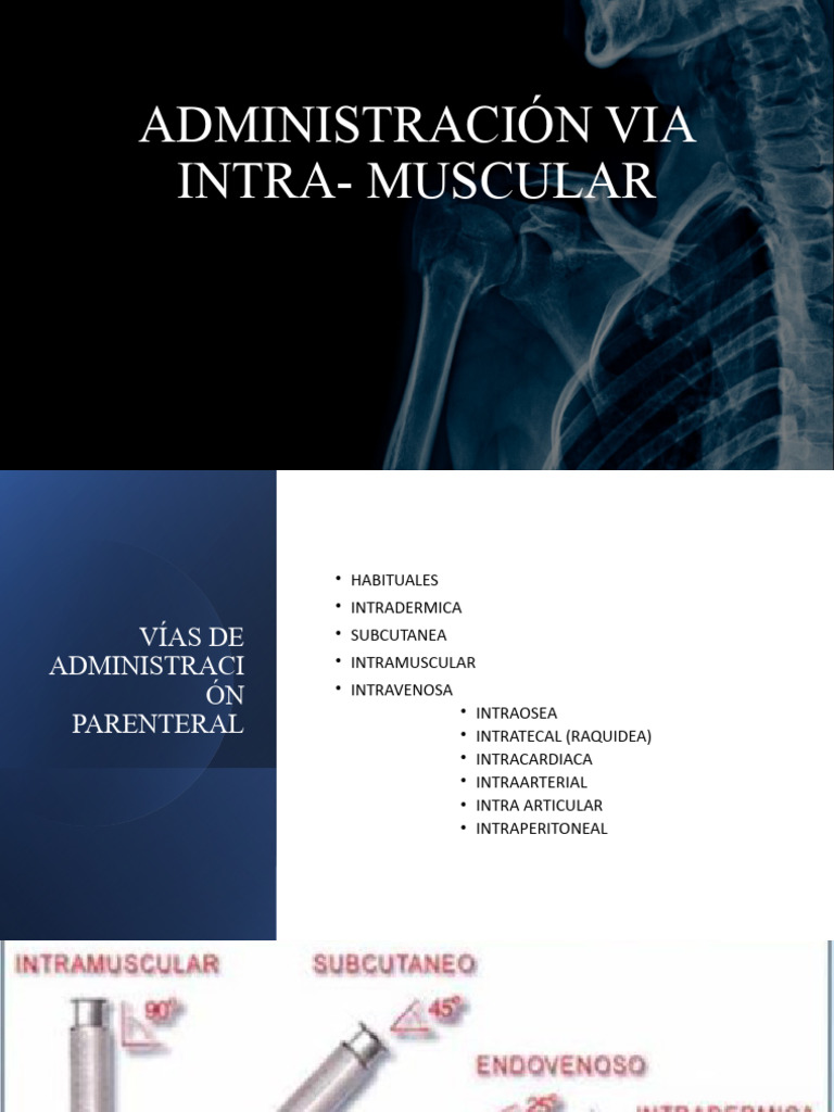 Administración Intramuscular: Guía Completa | PDF | Inyección (medicina ...