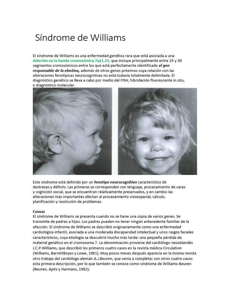 Síndrome de Williams: Genética y Lenguaje | PDF | Palabra | Memoria